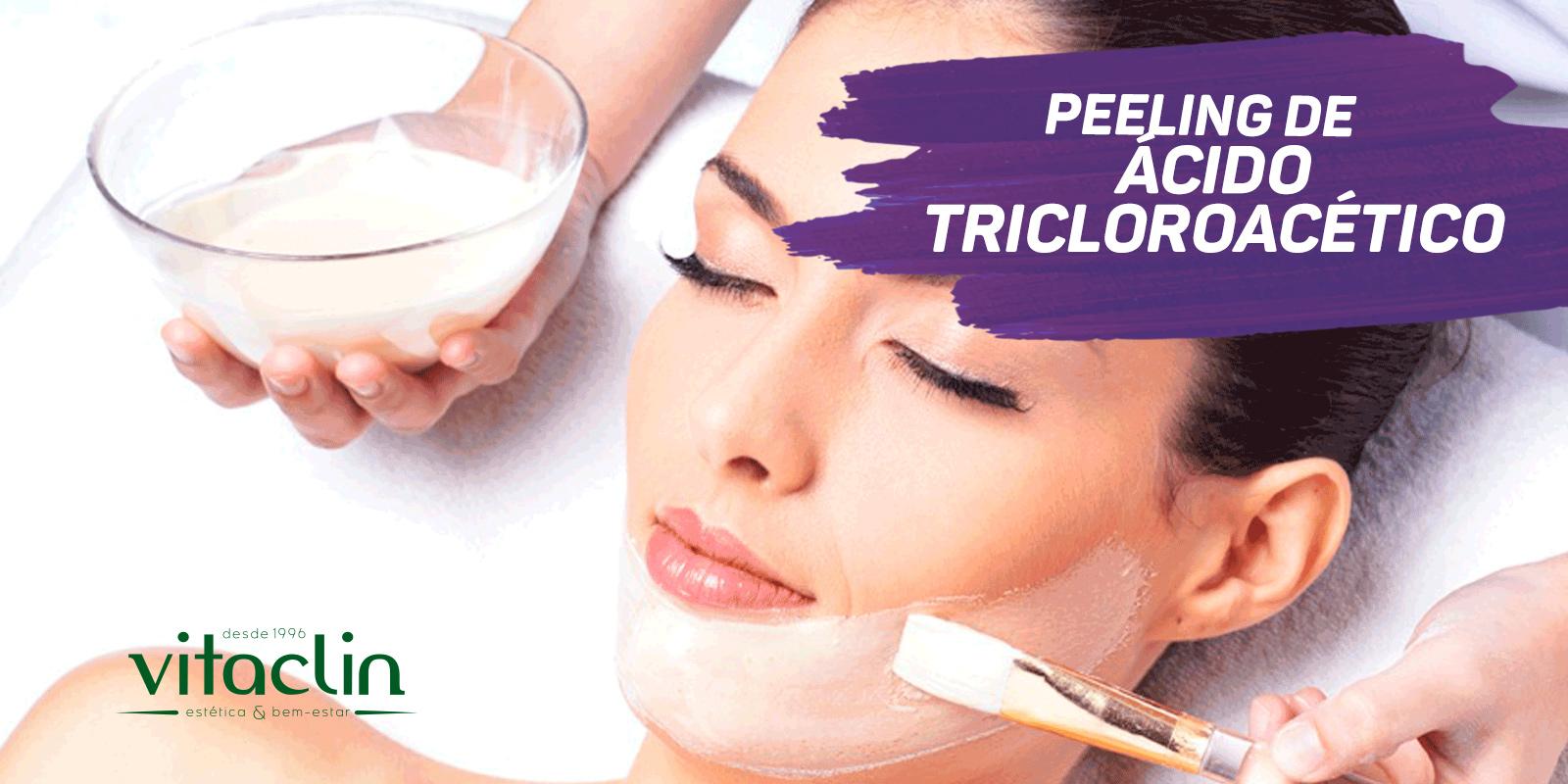 Peeling de Ácido Tricloroacético - Vitaclin